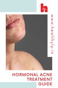 7 Tried & Tested Hormonal Acne Treatments That Really Work